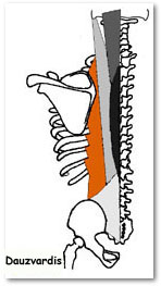 Erector Spinae-Iliocostalis