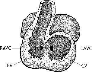 Atrioventricular canals