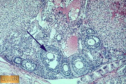 Histology Practical Female Reproductive Tract - Ovary, Oviduct, Uterus