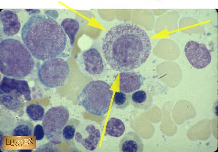 Histology Practical Bone Marrow and Hemopoiesis