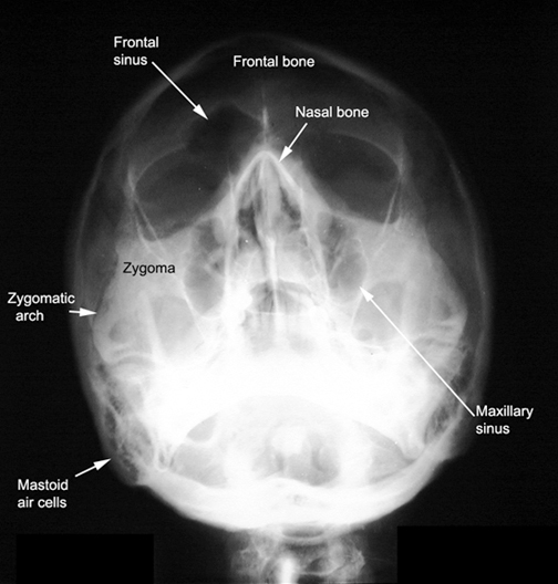 identify the structures click the image for labeling