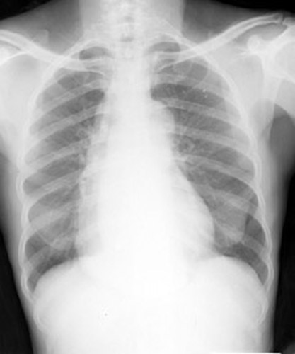 CXR self evaluation exercise 1
