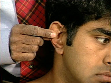 Inspect External Ear