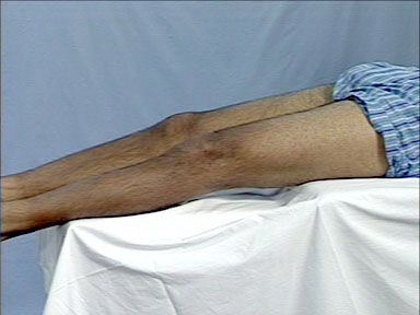 Muscles of Lower Extremity