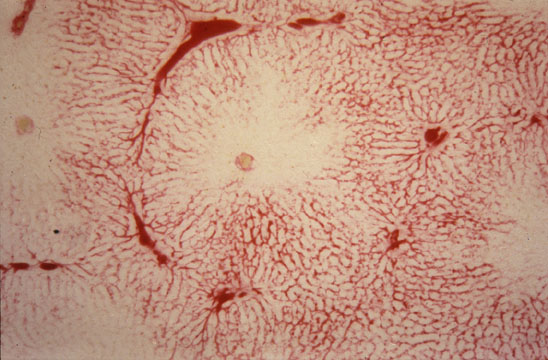 Review of Pathology of the Liver - Lobulation