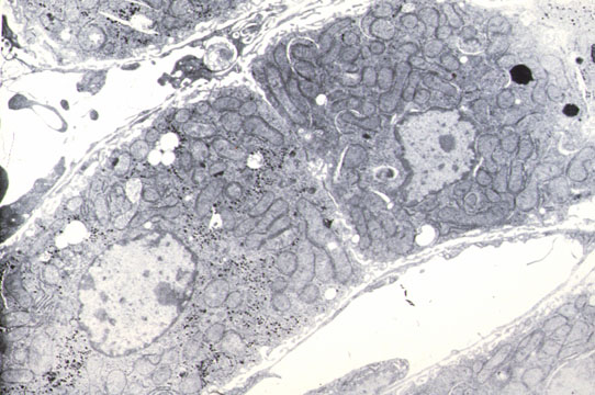 Normal Bile Ducts
