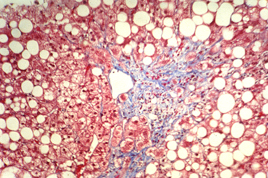 untitled [www.meddean.luc.edu]