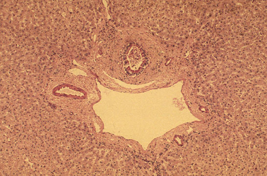 Portal and Septal Spaces