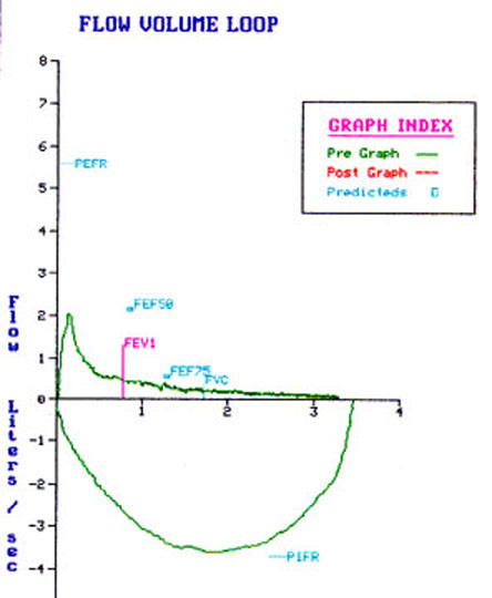 Flow Volume Loop