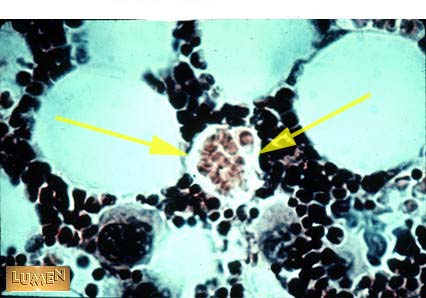 Histology Practical Bone Marrow and Hemopoiesis