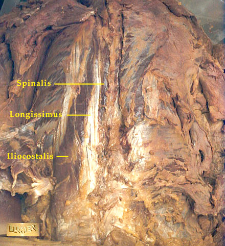 Back Dissection Step 3