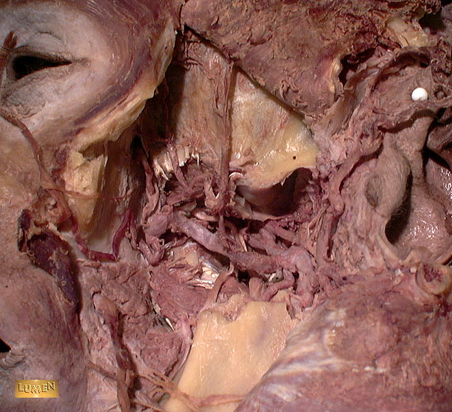 Face 4 Dissection
