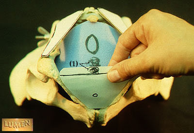 Perineu 2 Dissection