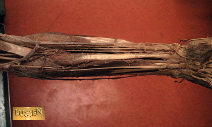 Arm and Forearm - Step 3