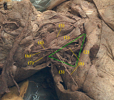 Posterior triangle 1 Dissection