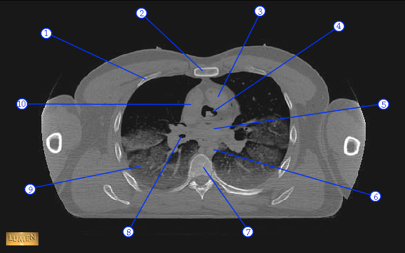Thorax Cross Section