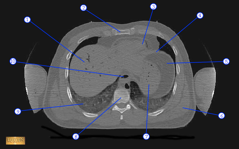 Thorax Cross Section
