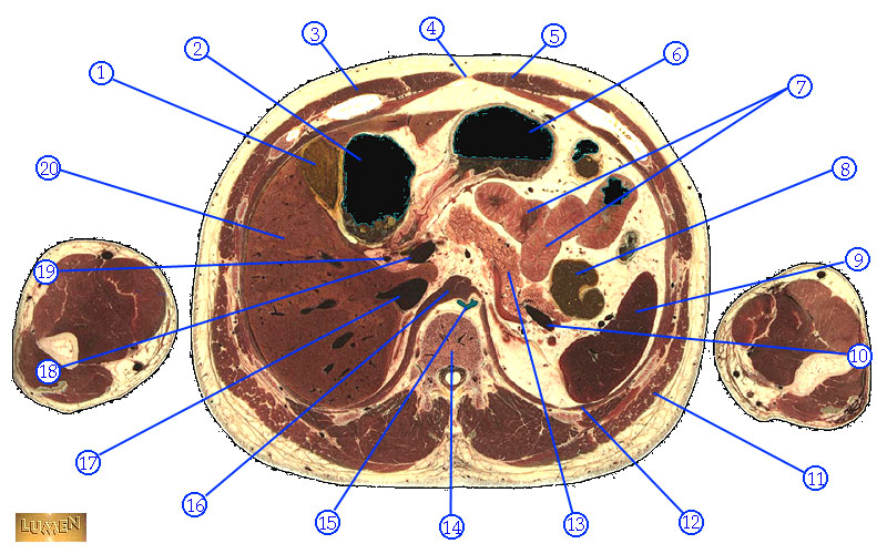 Abdomen Cross Section