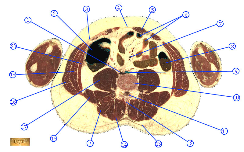 Abdomen Cross Section