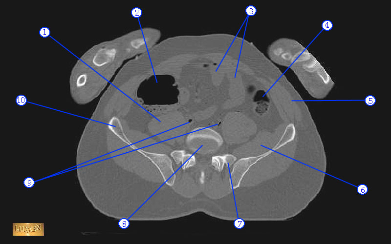 Pelvis Cross Section