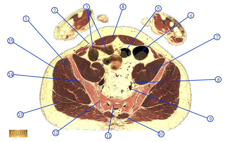 Pelvis Cross Section