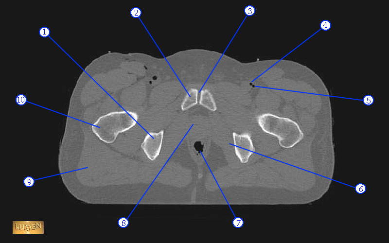 Pelvis Cross Section
