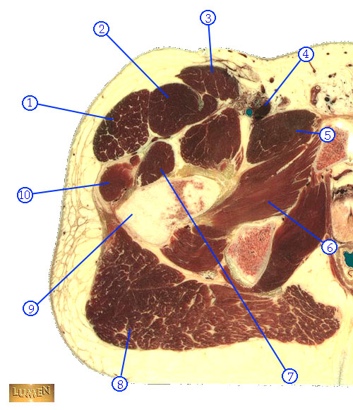 Lower limb cross sections