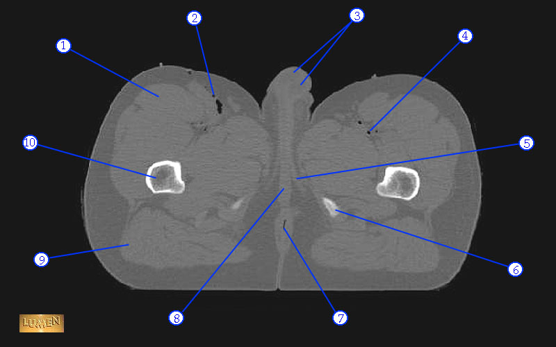 Pelvis Cross Section