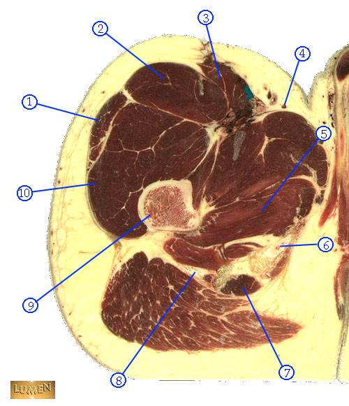 Lower limb cross sections