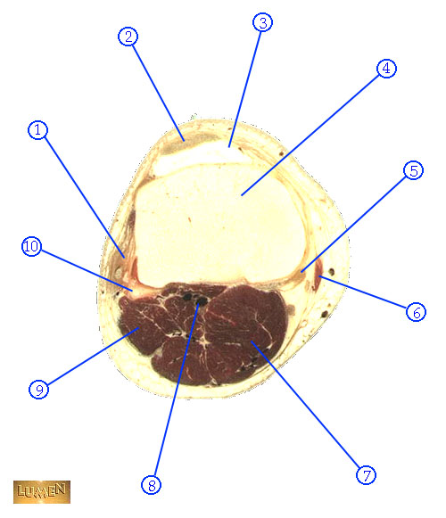 Lower limb cross sections