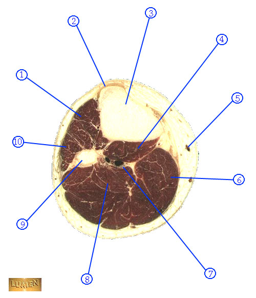 Lower limb cross sections