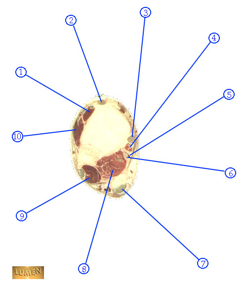 Lower limb cross sections