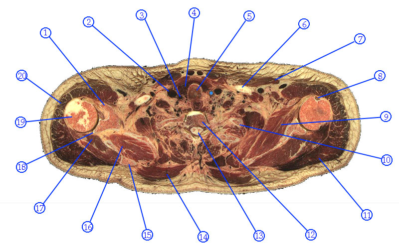 Thorax Cross Section