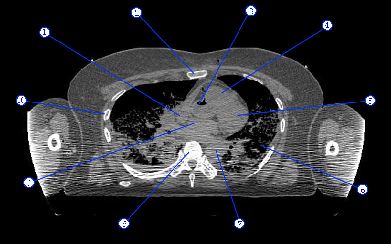 Thorax Cross Section