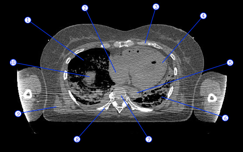Thorax Cross Section