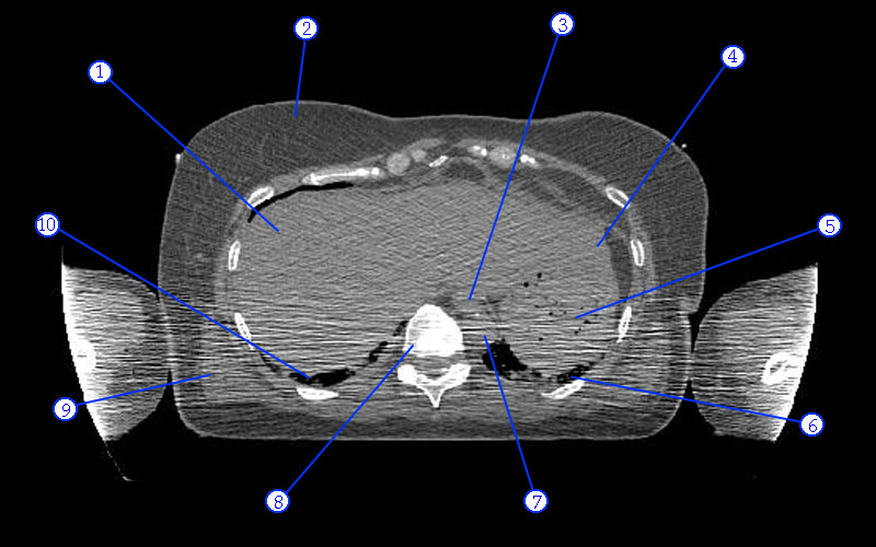 Thorax Cross Section