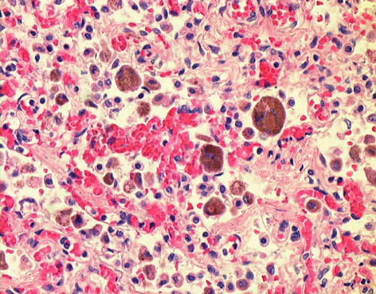 New Page 1 [www.meddean.luc.edu]