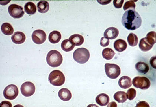 Send comments to Dr. A.J.Chandrasekhar M.D.