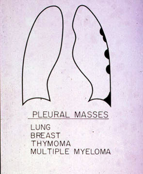 Pleural Masses