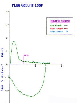 Pulmonary Function Test