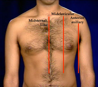 midsternal line a vertical line down the middle of sternum parasternal ...