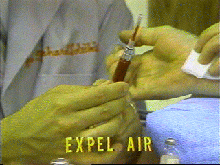 after the syringe is filled with about three cc s of blood withdraw the ...