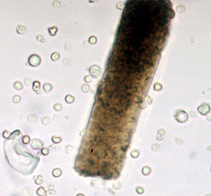Urine sediment Interpretive skills