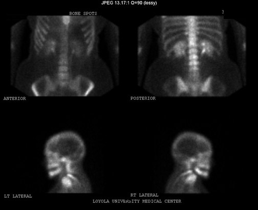 GI and Abdomen Radiologic Anatomy