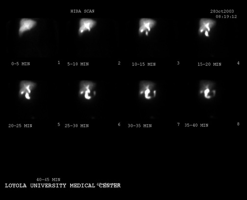 GI and Abdomen Radiologic Anatomy