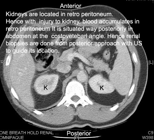GU Radiologic Anatomy