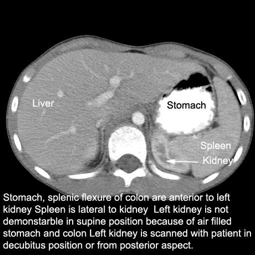 GU Radiologic Anatomy