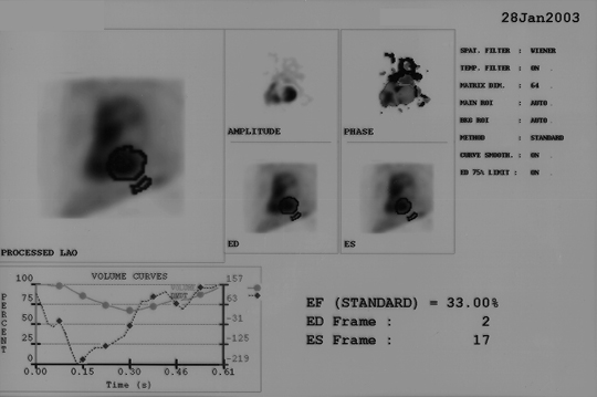 GI and Abdomen Radiologic Anatomy