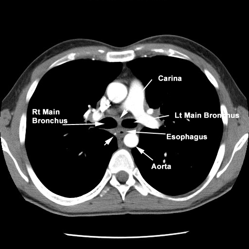 Course of Esophagus