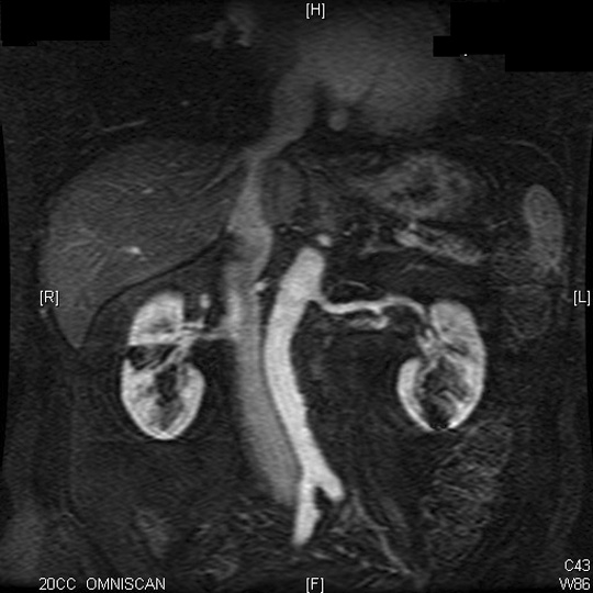 GI and Abdomen Radiologic Anatomy